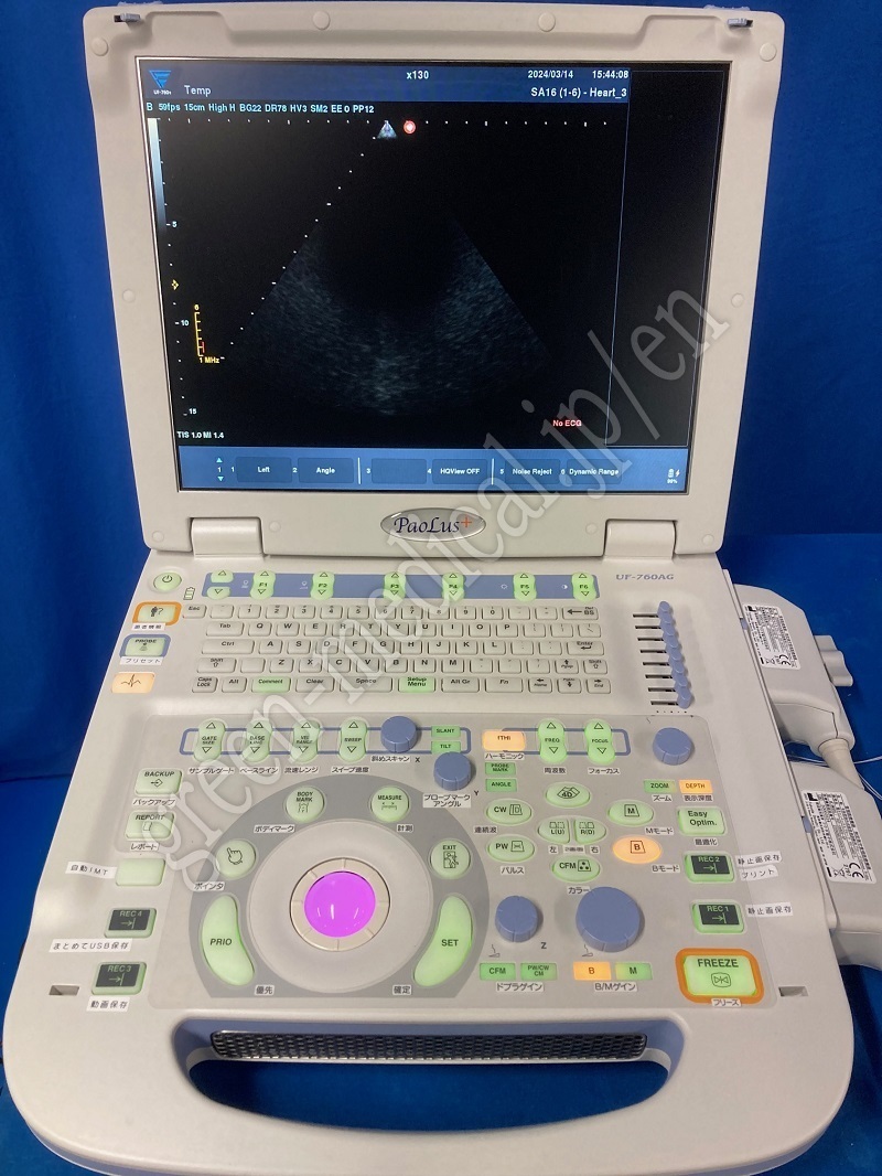 超音波診断装置 (フクダ電子株式会社 / 104584)￤中古医療機器など優良な医療機器の販売・買取ならグリーンメディカル